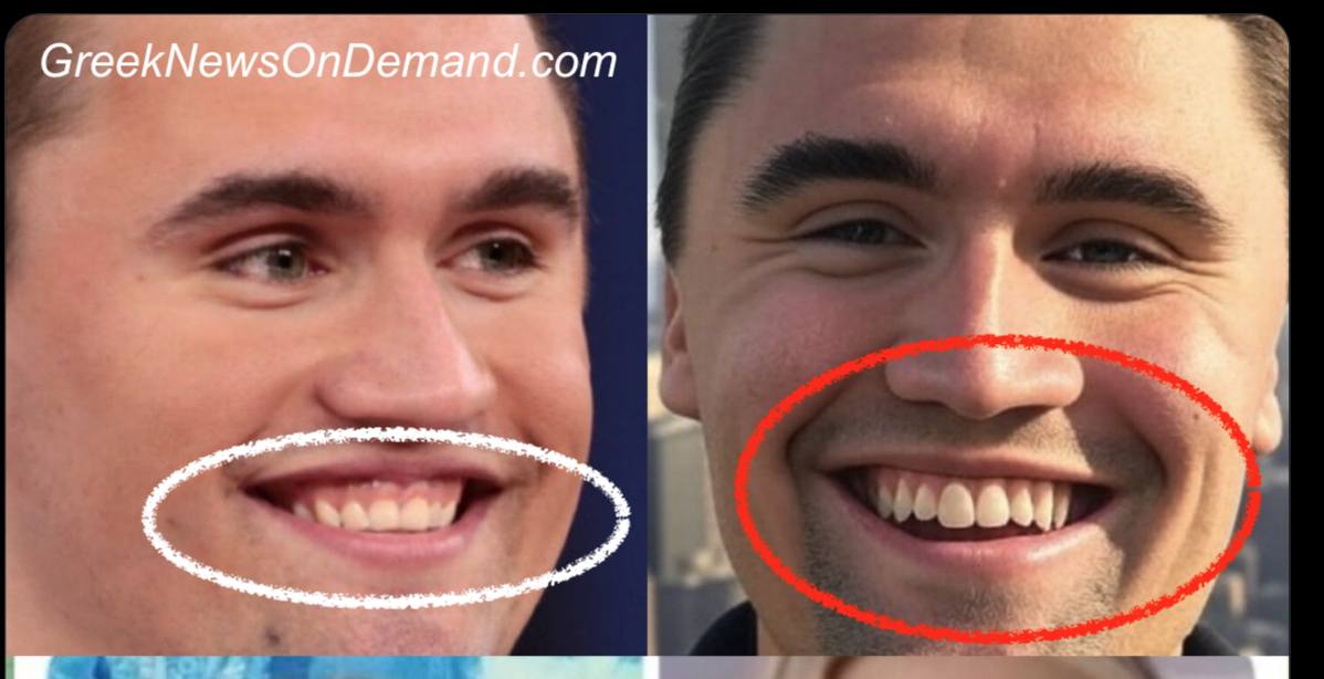 FAKE Charlie Kirk "Shooting": The TEETH...DON'T LIE! Neither do the ...